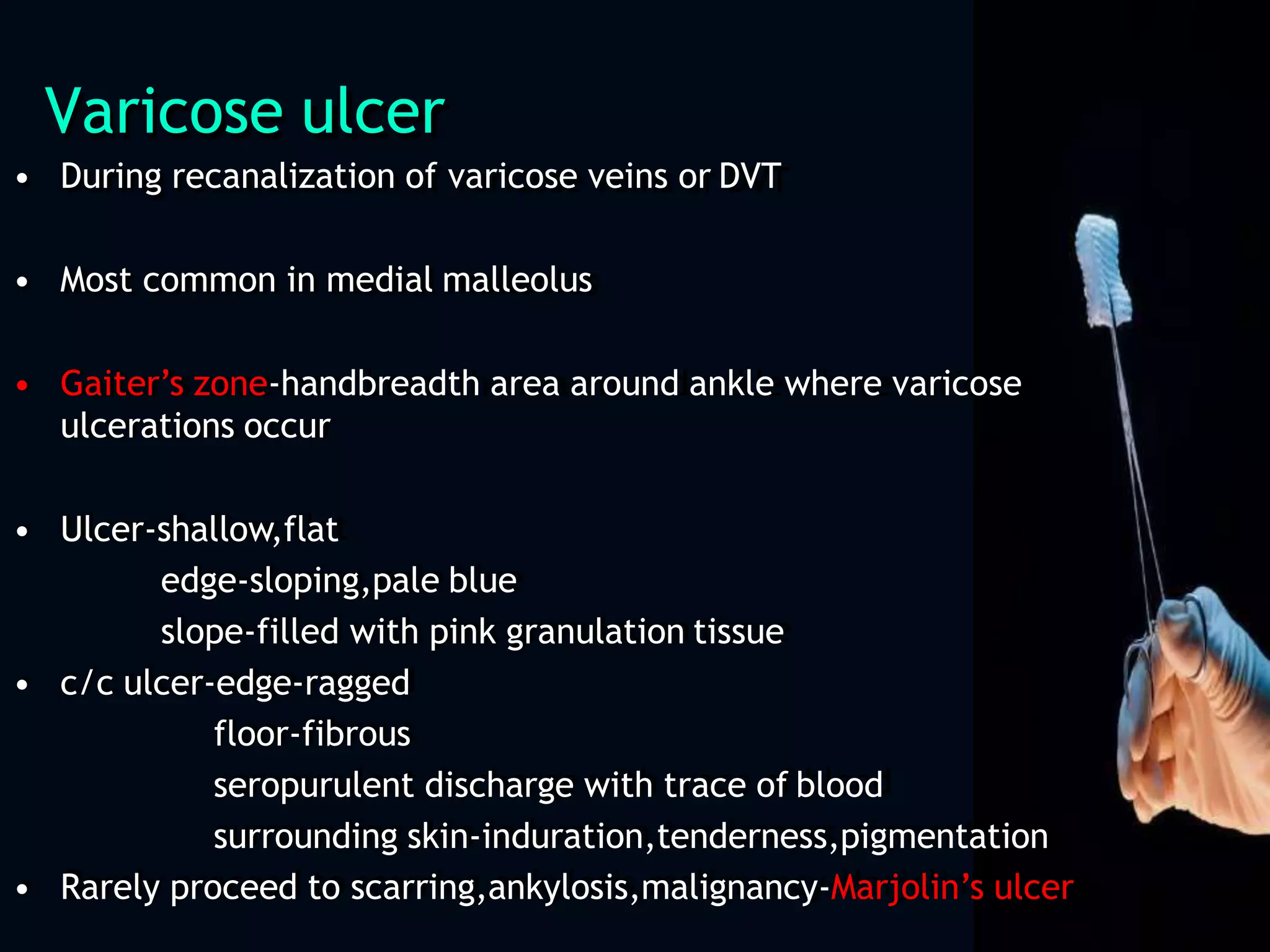 Varicose veins ppt | PPTX