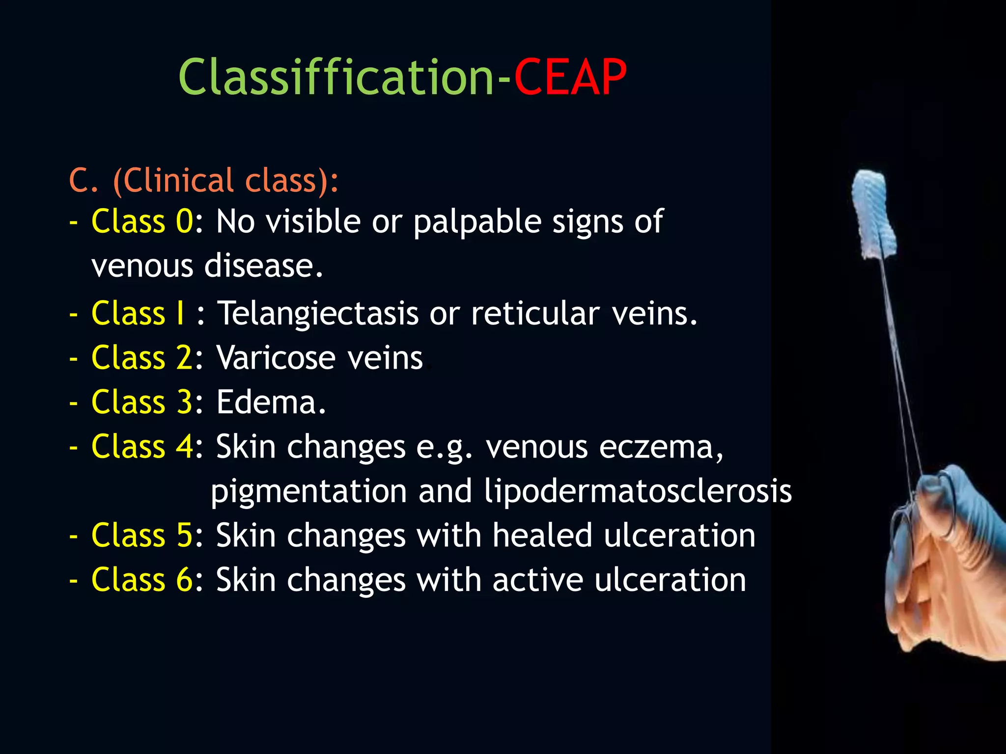 Varicose veins ppt | PPTX