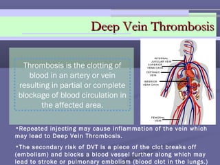 Vein care & safer injection tips | PPT