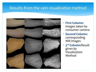 Vein pattern Recodnition | PPTX | Genetics | Science