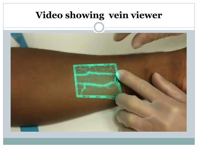 Veins Illumination Device Pptx Blood Disorders Diseases And
