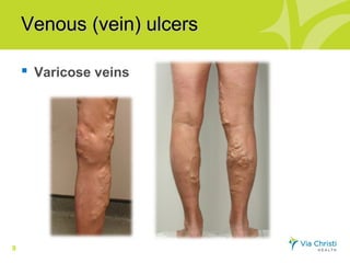 Veins, trains and automobiles | PPT