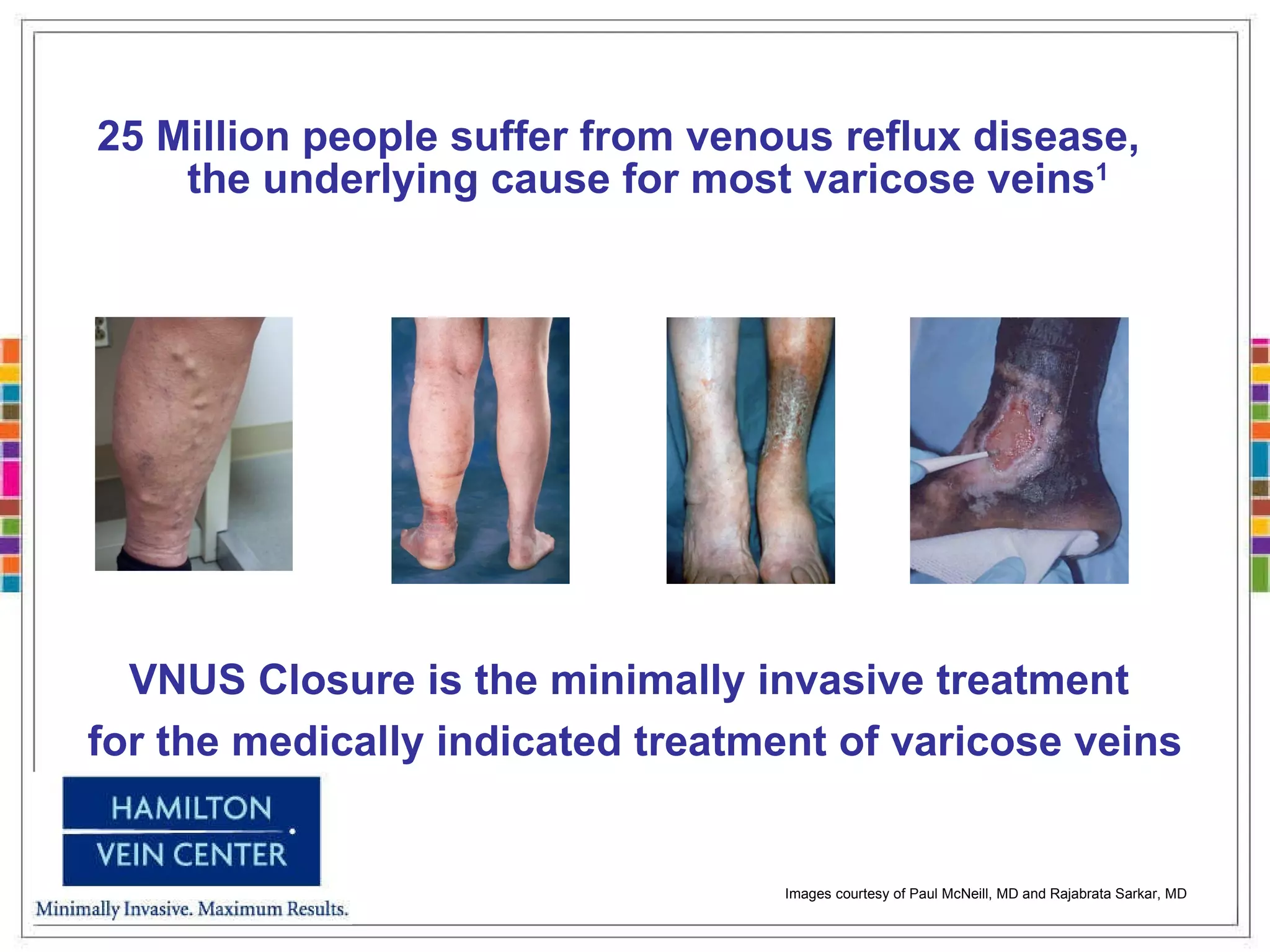 Vein Presentation For Family Practice | PPT