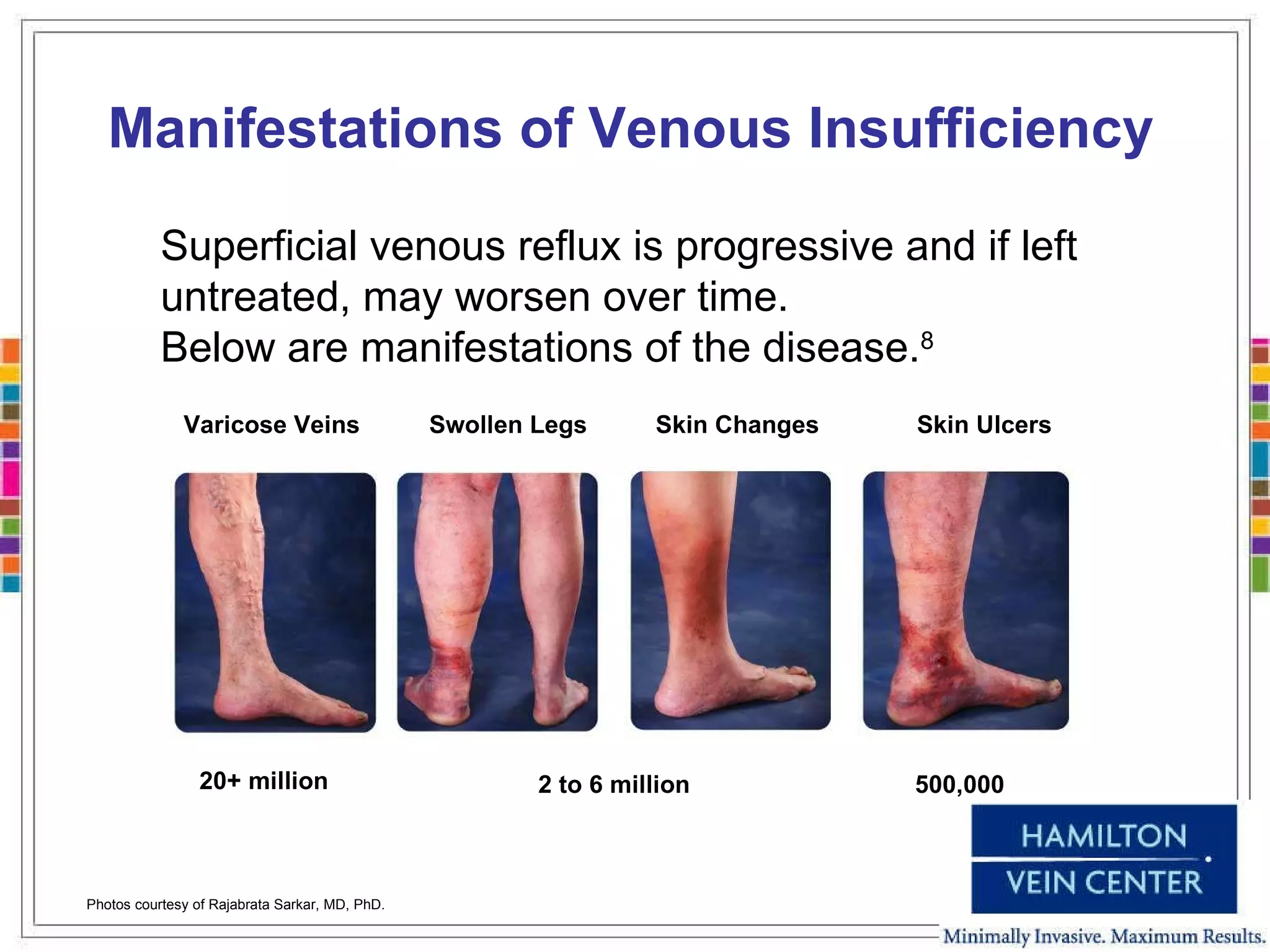 Vein Presentation For Family Practice | PPT