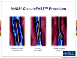 Vein Presentation For Family Practice | PPT