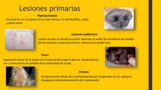 VelardeLitzi-LESIONES PRIMARIAS Y SECUNDARIAS.pptx