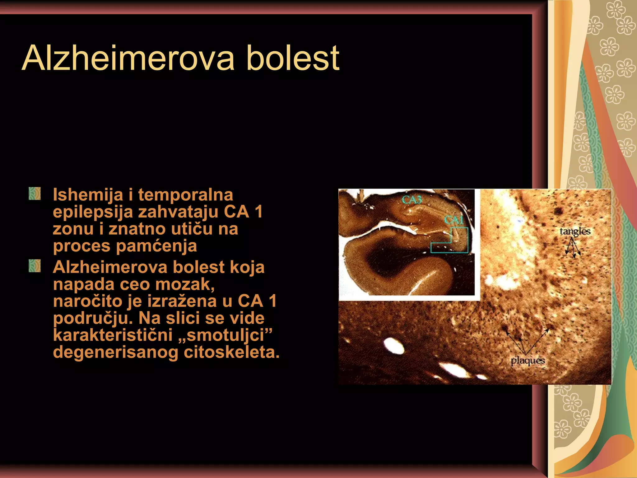 Anatomija- Veliki mozak | PPS