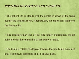 RIBS AND STERNUM RADIO-GRAPHIC PROJECTIONS | PPTX