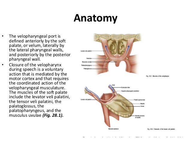 Velopharyngeal dysfunction (VPD)