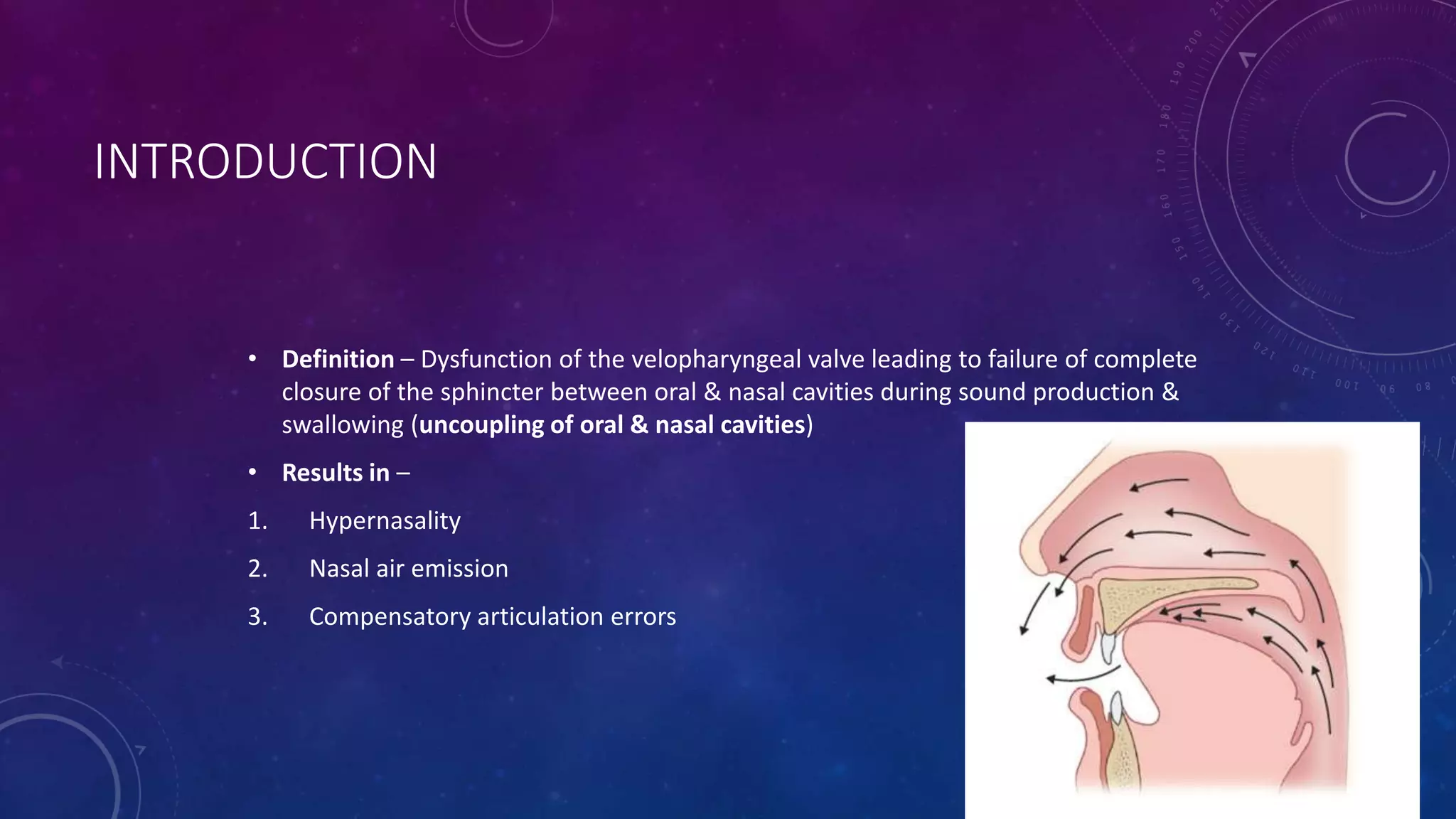 Velopharyngeal dysfunction | PPTX