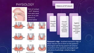 Velopharyngeal dysfunction | PPTX