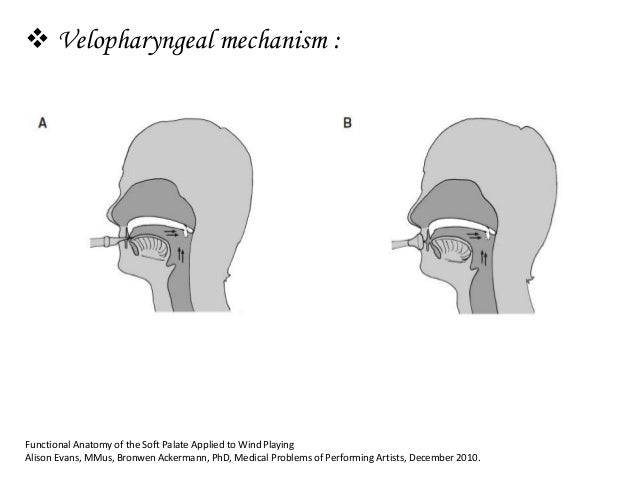 Velopharyngeal insufficiency parag