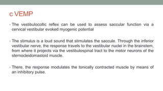 Vestibular evoked myogenic potential seminar | PPTX
