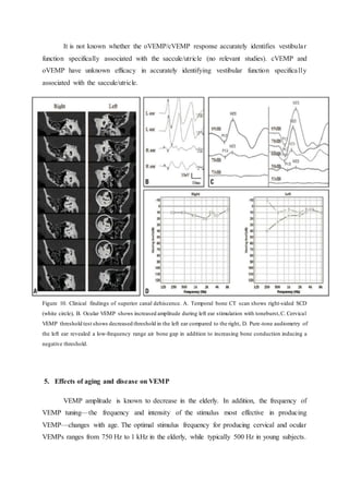 VEMP Dr.dr. HR Yusa Herwanto, MKed(ORL-HNS), Sp.THTKL(K) | DOCX | Ear ...