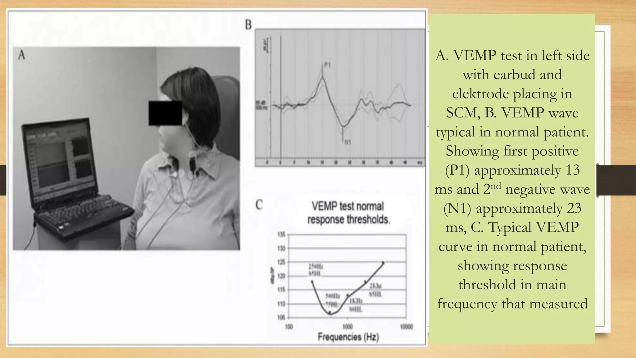 VEMP (PPT) Dr.dr.HR Yusa Herwanto, MKed(ORL-HNS), Sp.THTKL(K) | PPTX