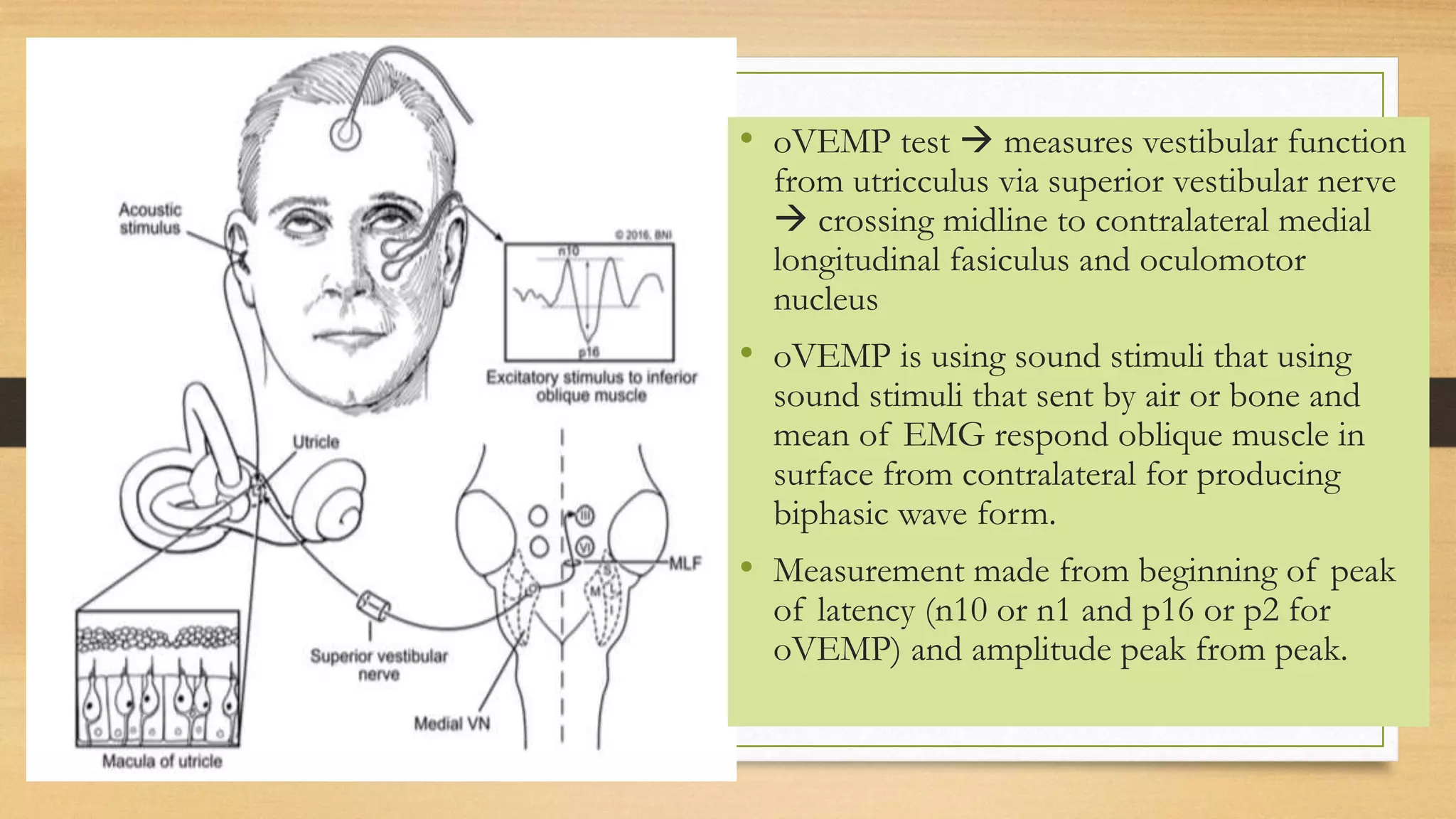 VEMP (PPT) Dr.dr.HR Yusa Herwanto, MKed(ORL-HNS), Sp.THTKL(K) | PPTX
