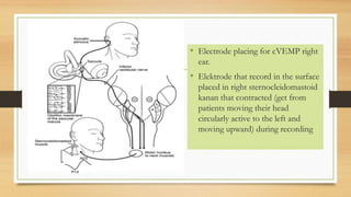 VEMP (PPT) Dr.dr.HR Yusa Herwanto, MKed(ORL-HNS), Sp.THTKL(K) | PPTX
