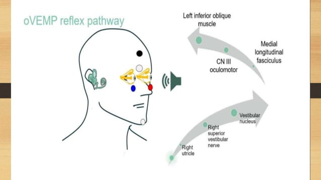 VEMP (PPT) Dr.dr.HR Yusa Herwanto, MKed(ORL-HNS), Sp.THTKL(K) | PPTX