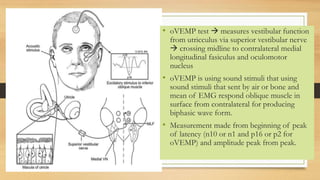 VEMP (PPT) Dr.dr.HR Yusa Herwanto, MKed(ORL-HNS), Sp.THTKL(K) | PPTX