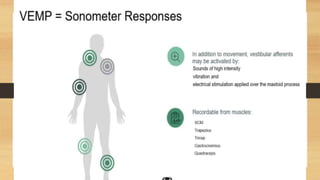 VEMP (PPT) Dr.dr.HR Yusa Herwanto, MKed(ORL-HNS), Sp.THTKL(K) | PPTX