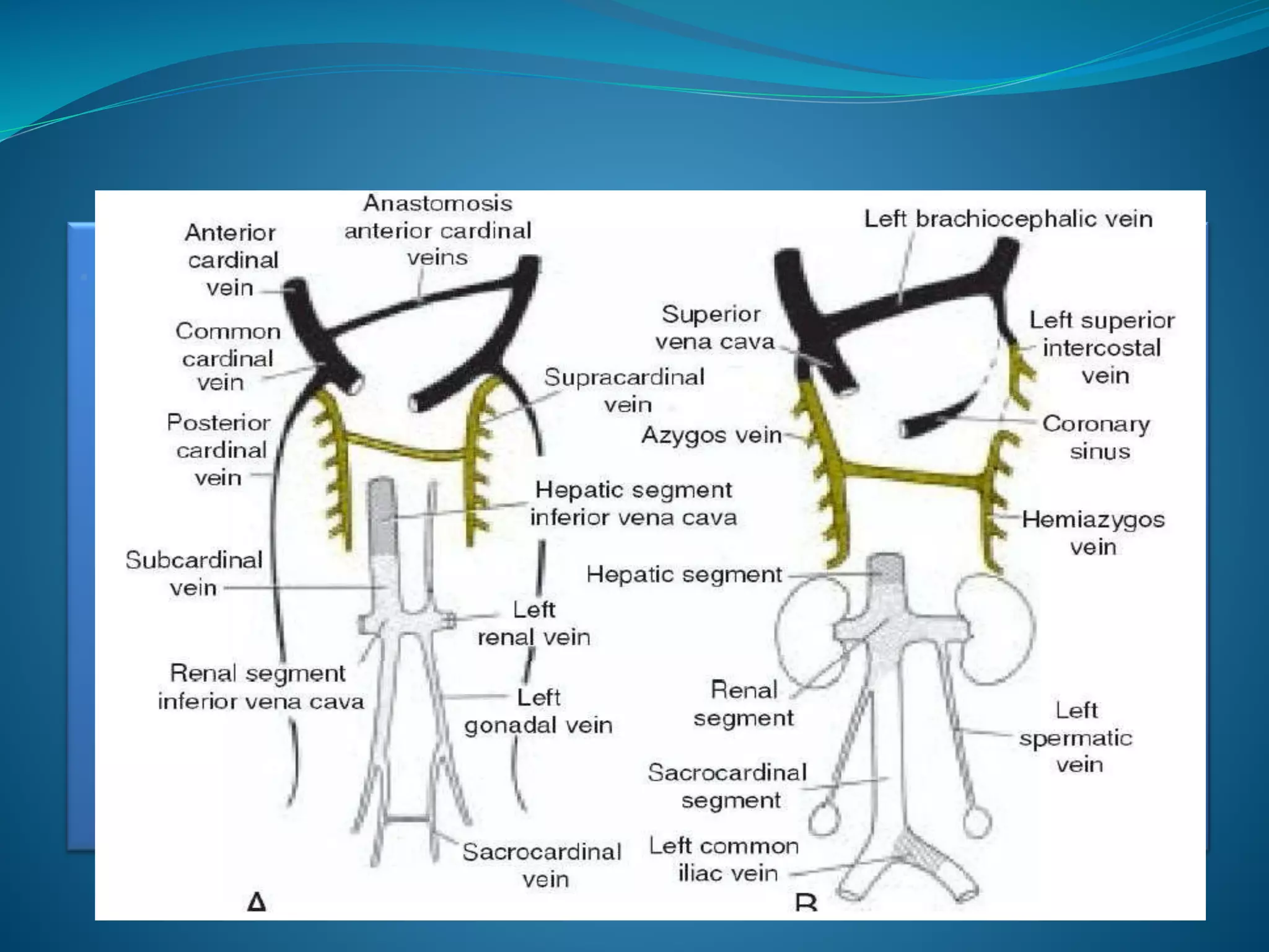 Vena cava anatomy and variants | PPTX
