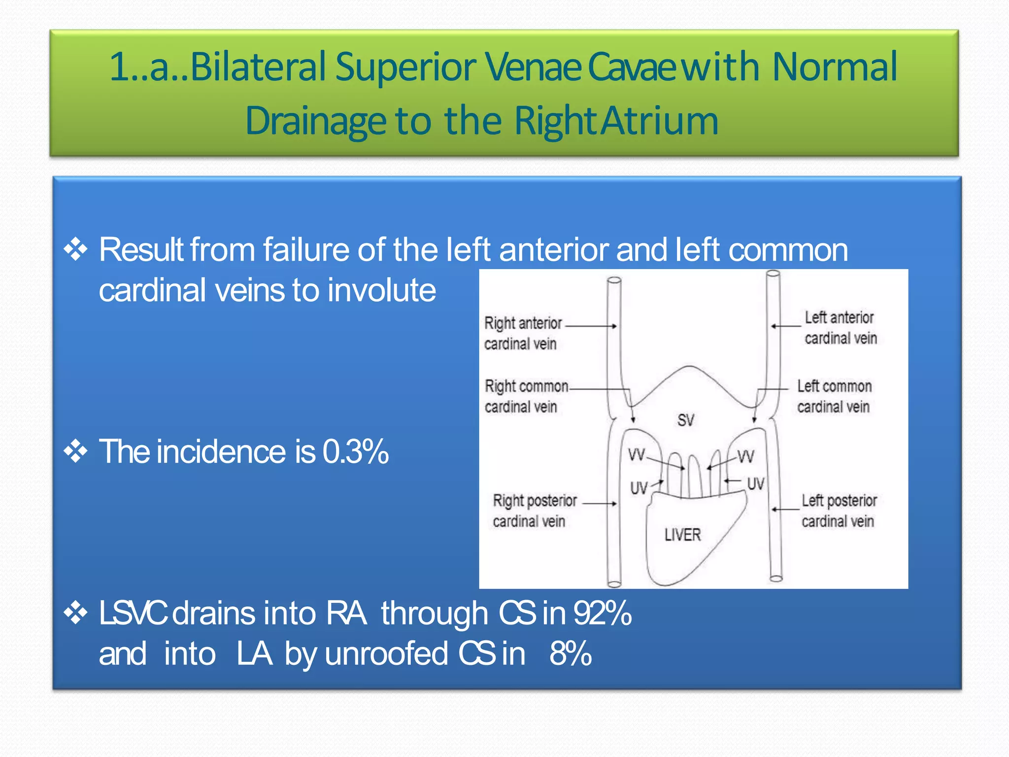 Vena cava anatomy and variants | PPTX