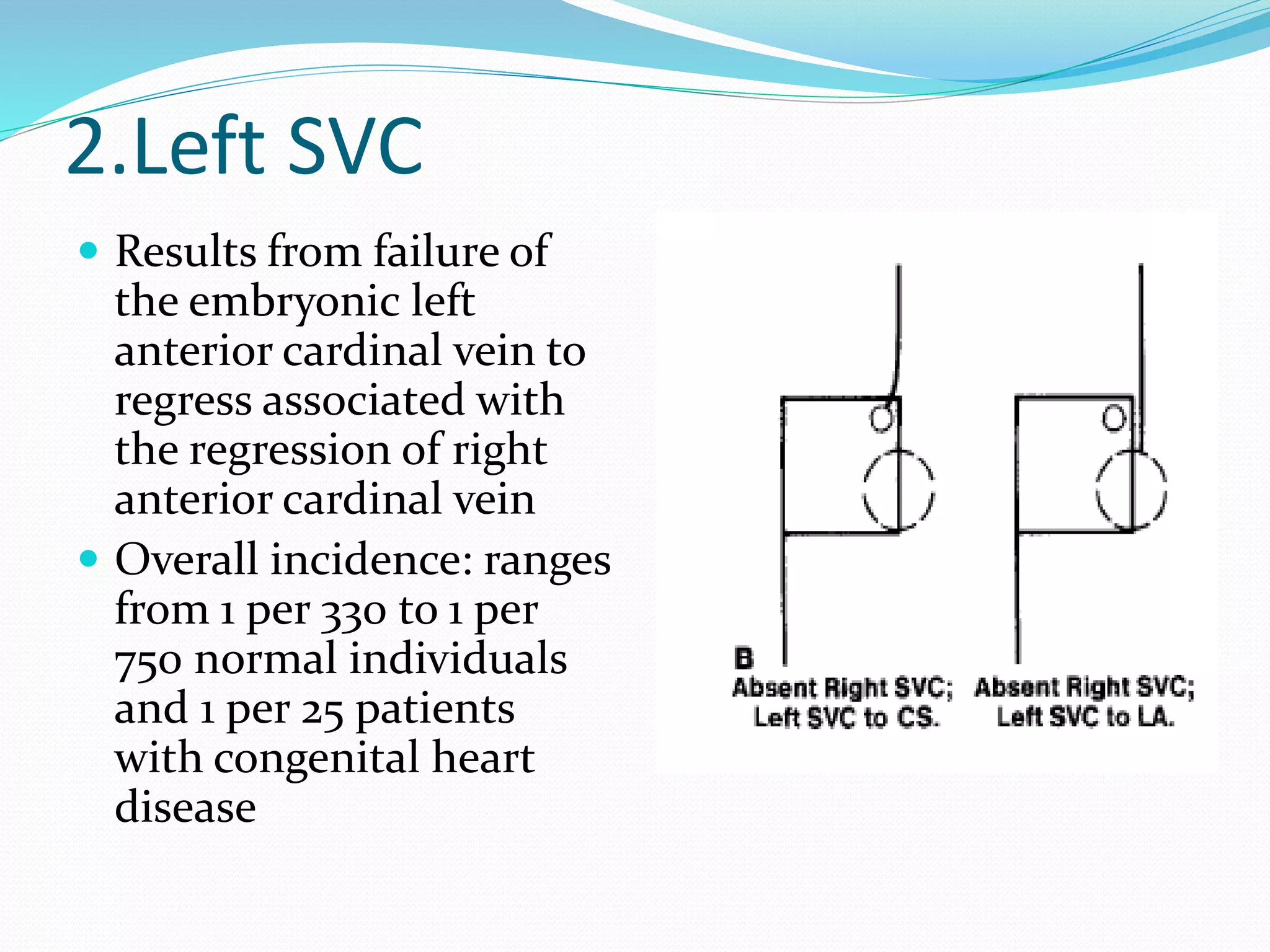 Vena cava anatomy and variants | PPTX