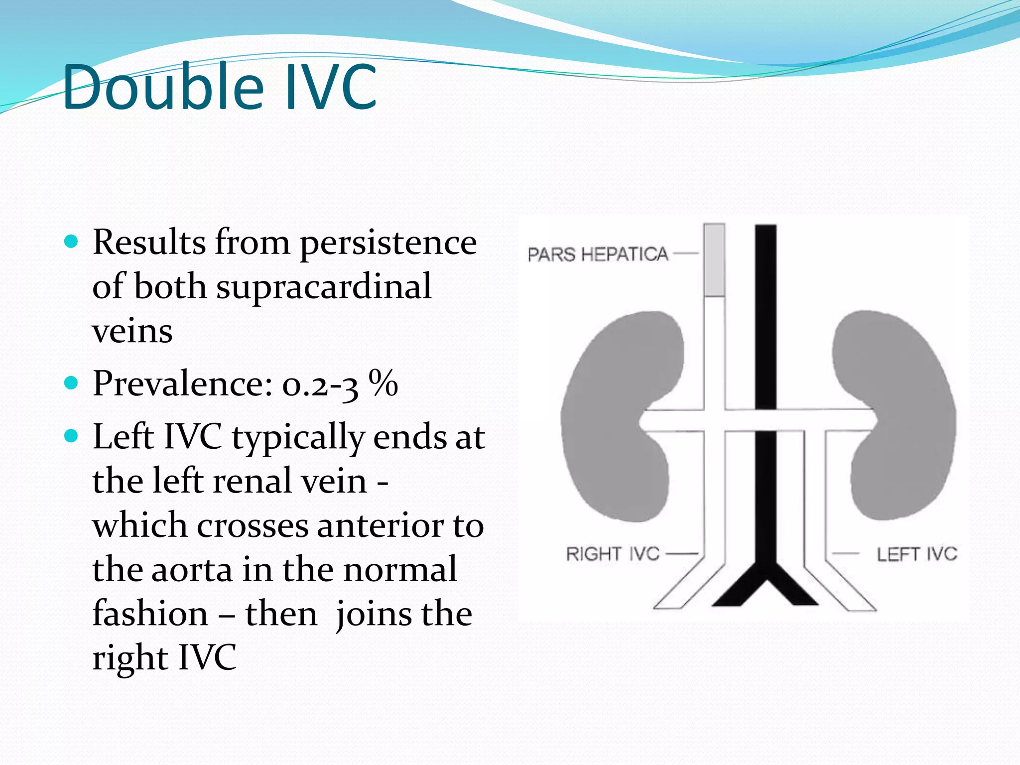 Vena cava anatomy and variants | PPTX