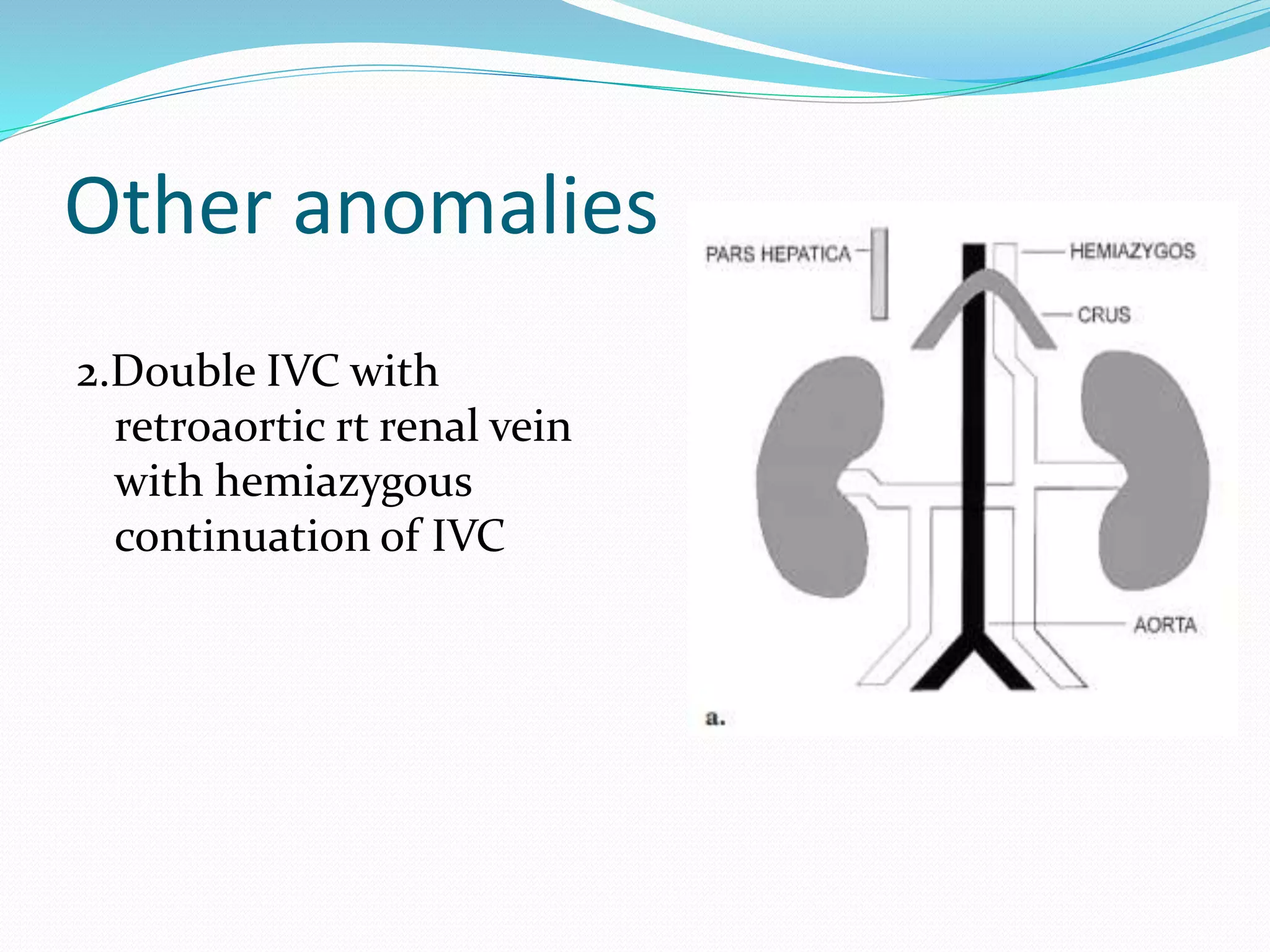 Vena cava anatomy and variants | PPTX