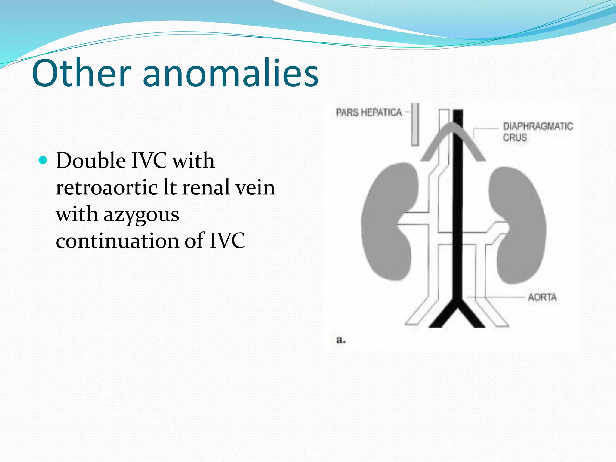 Vena cava anatomy and variants | PPTX