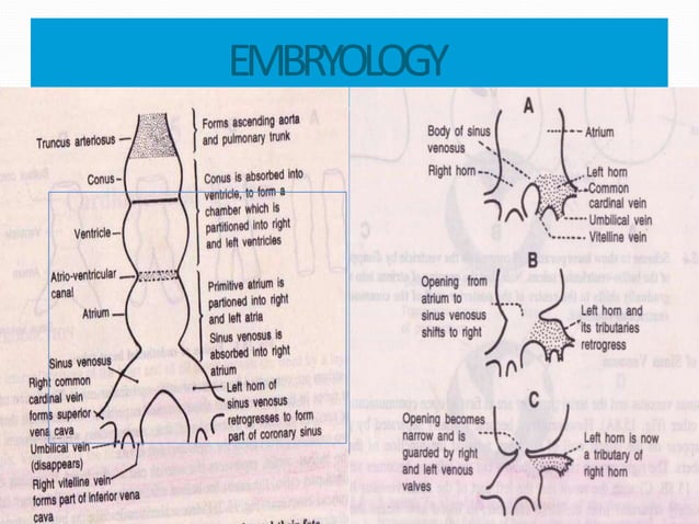 Vena cava anatomy and variants | PPTX | Pregnancy | Reproductive Health