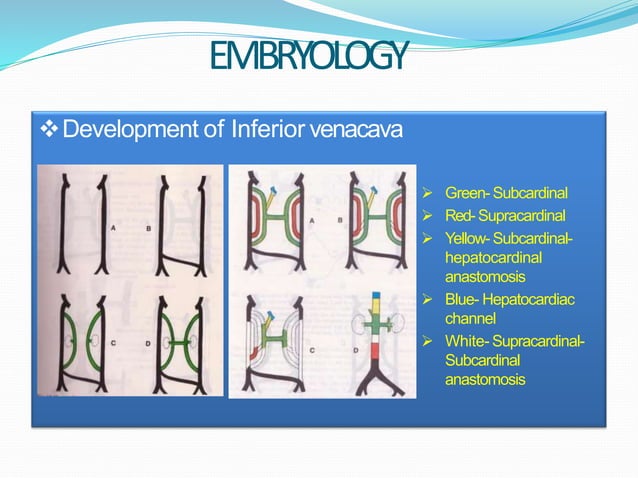 Vena cava anatomy and variants | PPTX | Pregnancy | Reproductive Health