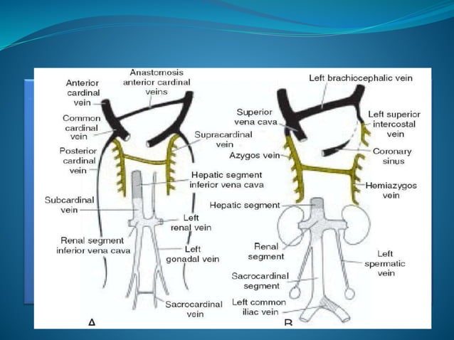Vena cava anatomy and variants | PPTX | Pregnancy | Reproductive Health