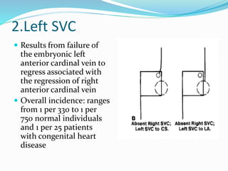 Vena cava anatomy and variants | PPTX