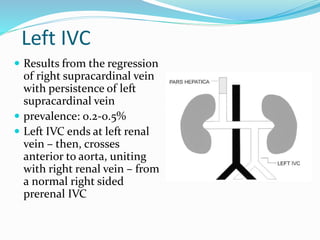 Vena cava anatomy and variants | PPTX