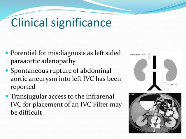Vena cava anatomy and variants | PPTX | Pregnancy | Reproductive Health