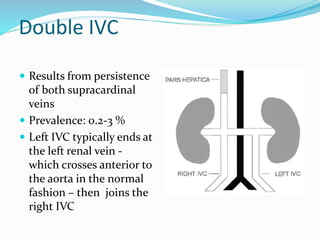 Vena cava anatomy and variants | PPTX
