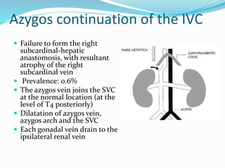 Vena cava anatomy and variants | PPTX