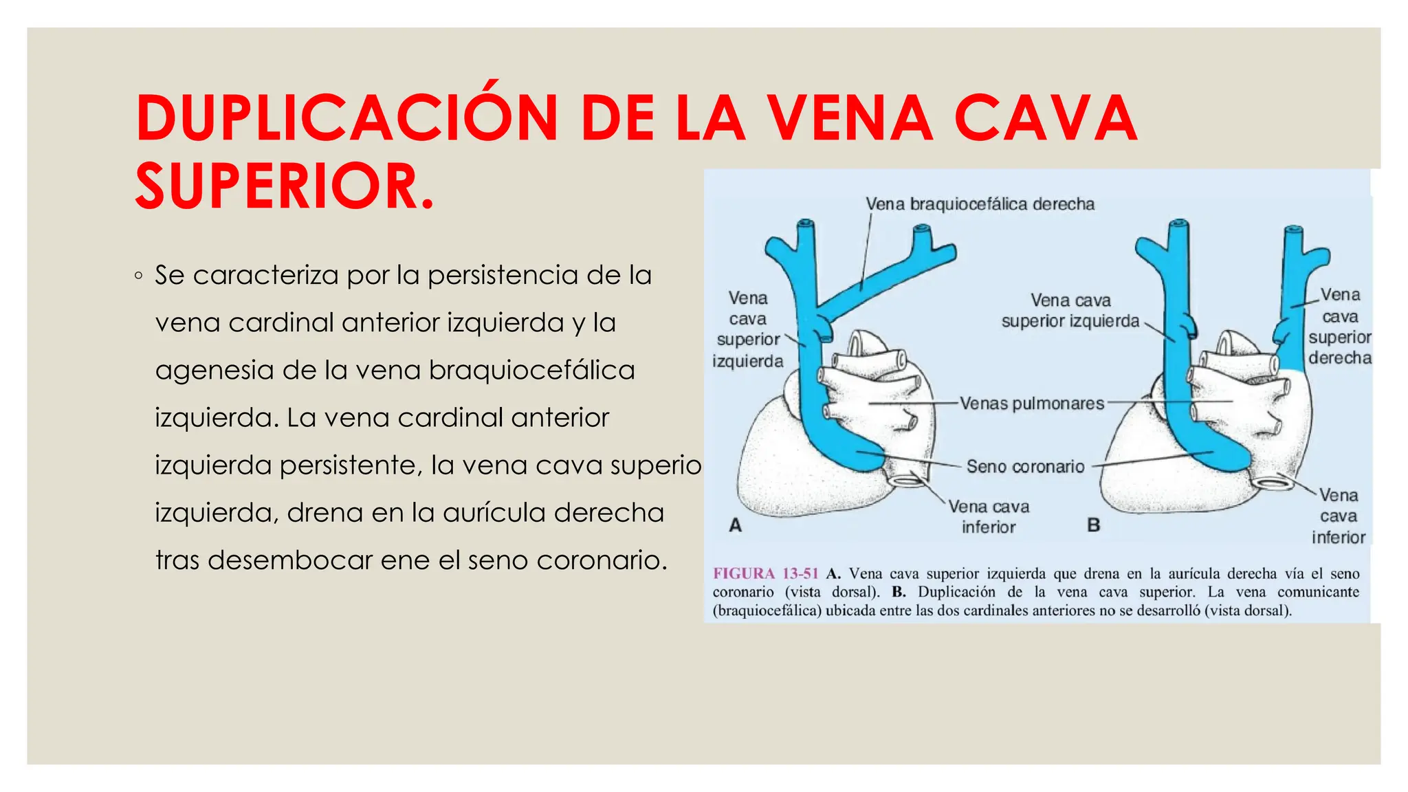 VENA CAVA SUPERIOR IZQUIERDA Y DUPLICACION DE LA VENA CAVA SUPERIOR. (1 ...