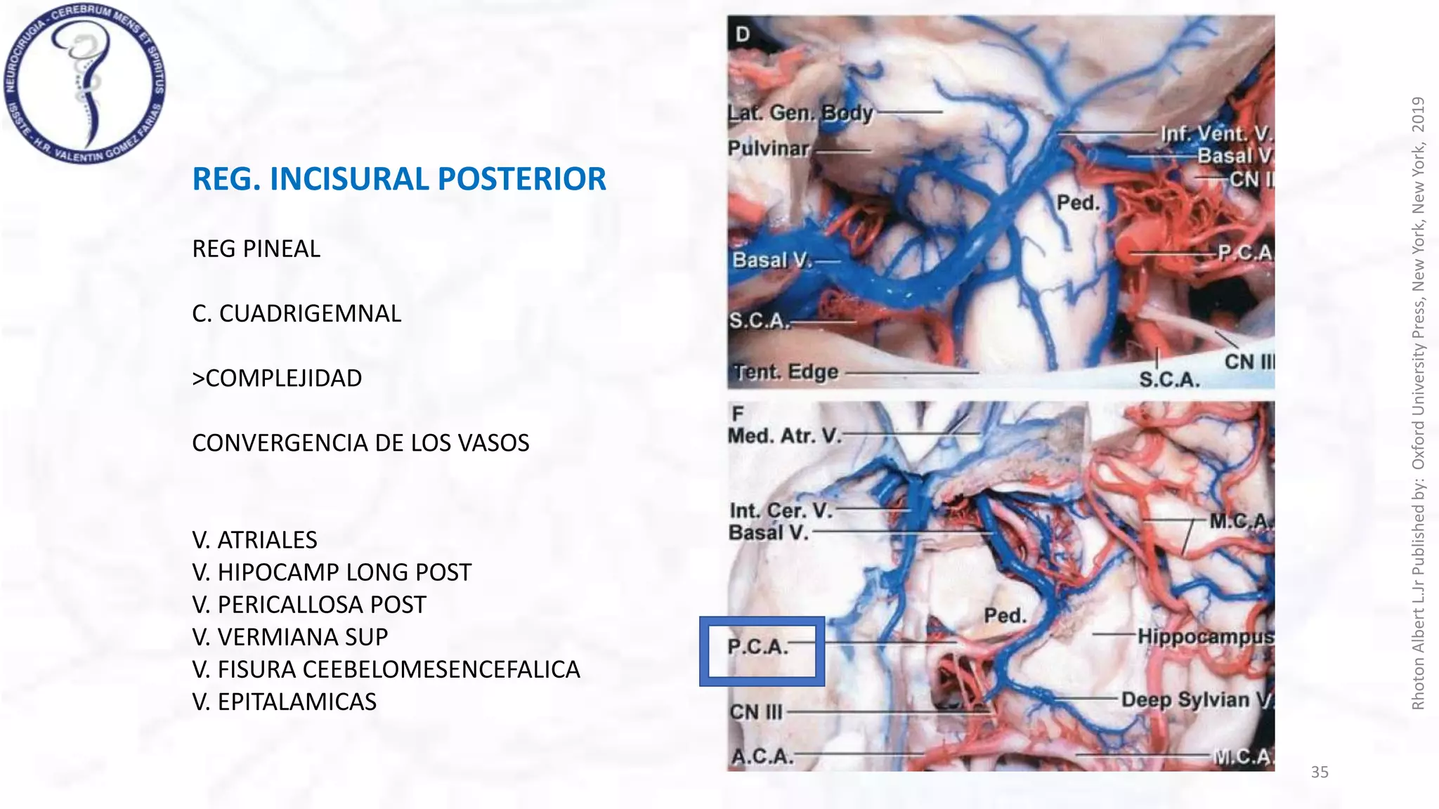 VENAS CEREBRALES rhoton .pptx