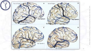 VENAS CEREBRALES rhoton .pptx