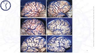 VENAS CEREBRALES rhoton .pptx