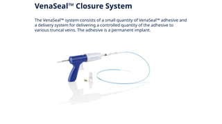 VenaSeal.pptx glue therapy for varicose veins | PPTX