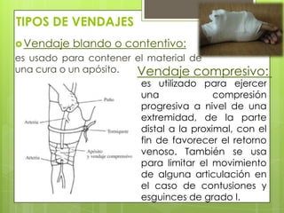 Vendajes | PPTX