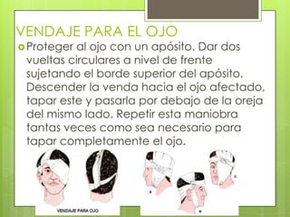 Vendajes | PPTX