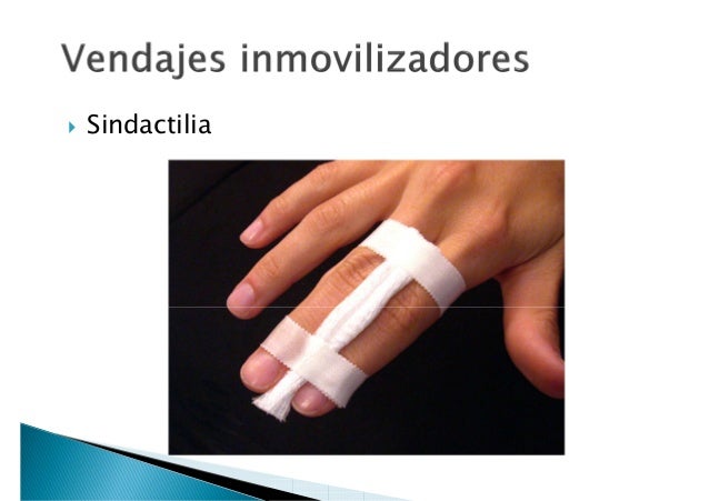 Traumatología de Urgencias