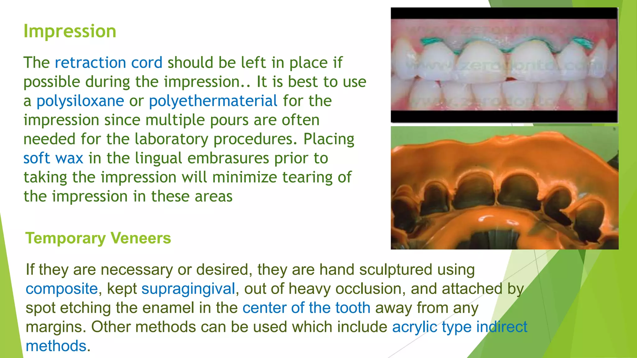 the Veneer step by step | PPTX