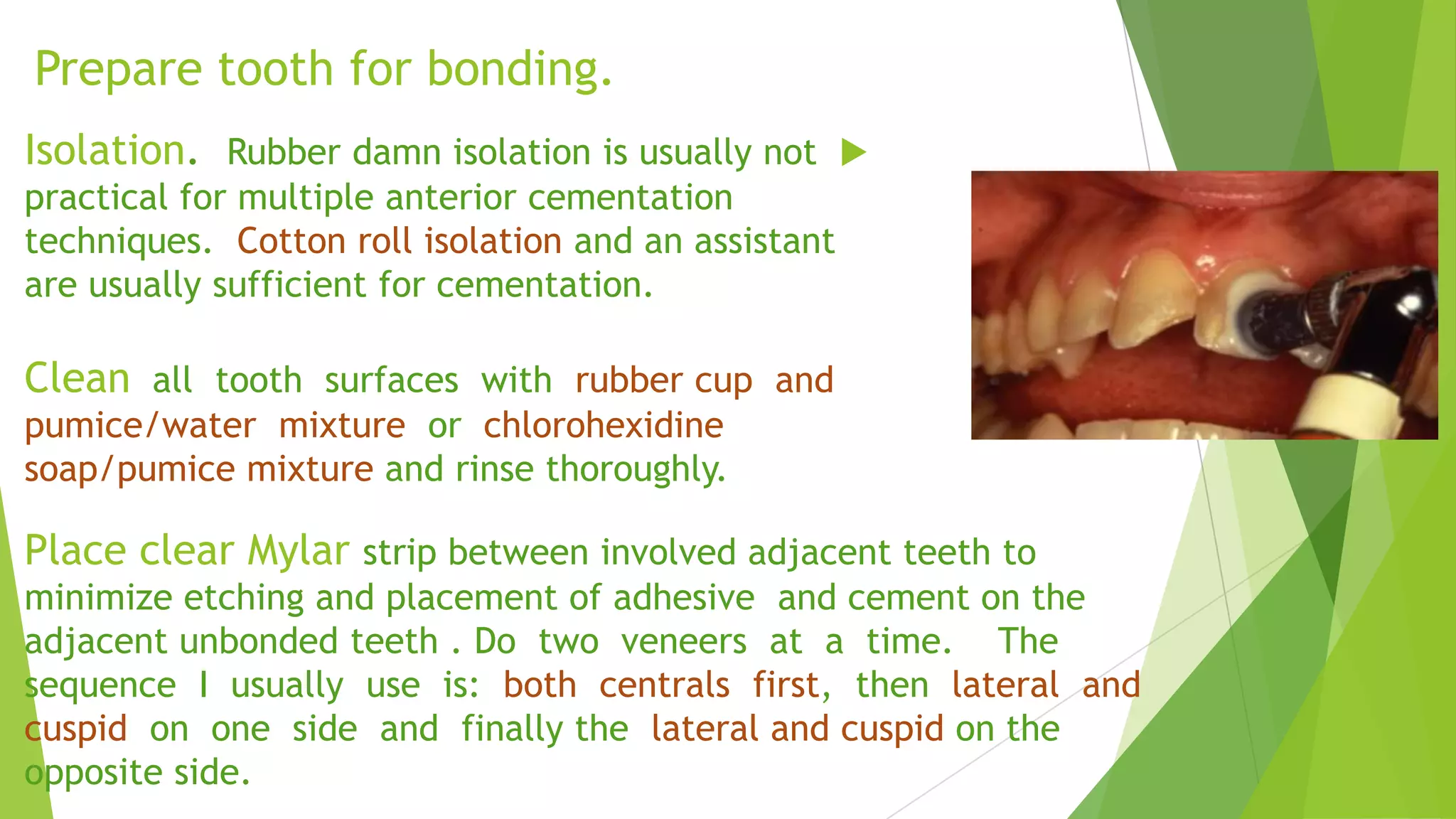 the Veneer step by step | PPTX