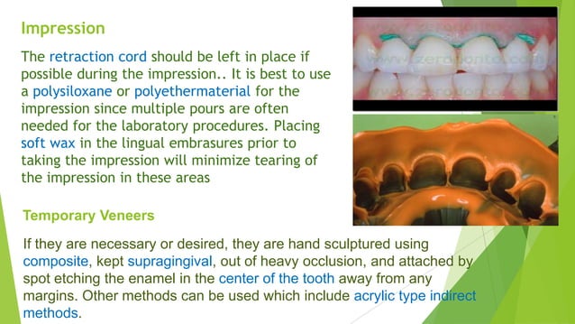 the Veneer step by step | PPTX | Oral care | Personal Care