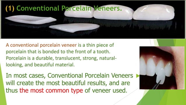 the Veneer step by step | PPTX | Oral care | Personal Care
